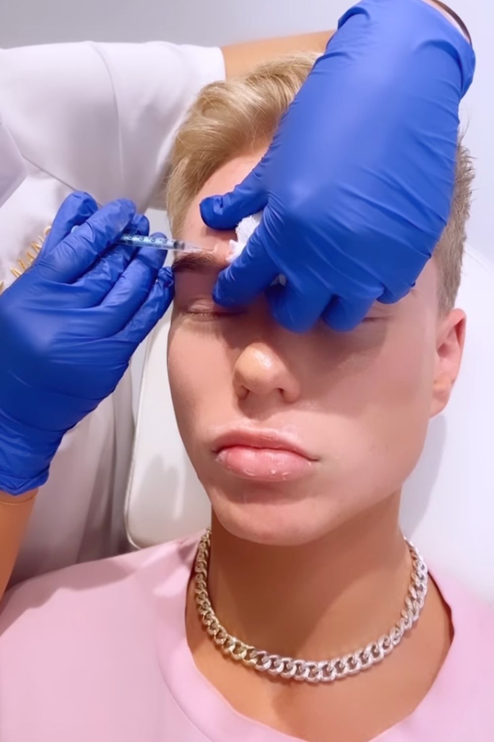 Jack Vidgen's Botox and filler: Inside his candid cosmetic journey ...