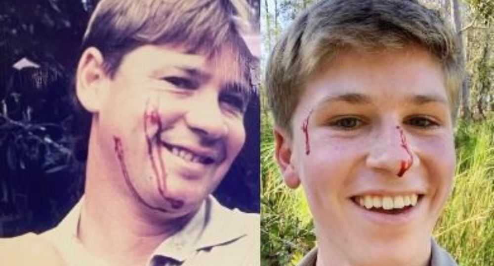 Robert Irwin left bruised and bloodied after alarming animal encounter ...