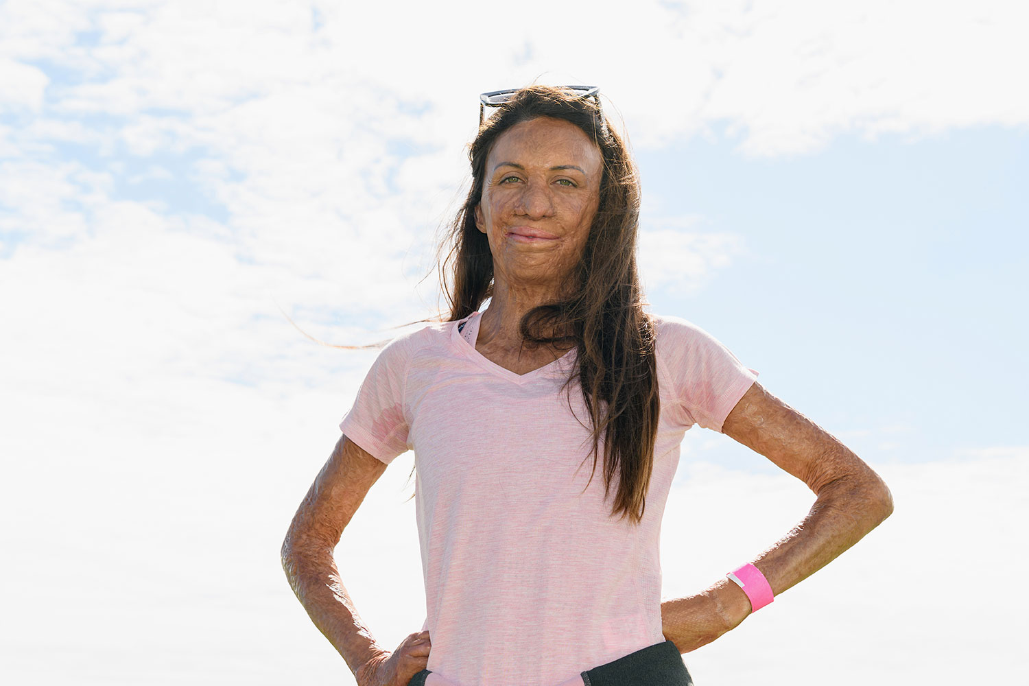 Turia Pitt sparks movement to help businesses in bushfire areas | New Idea